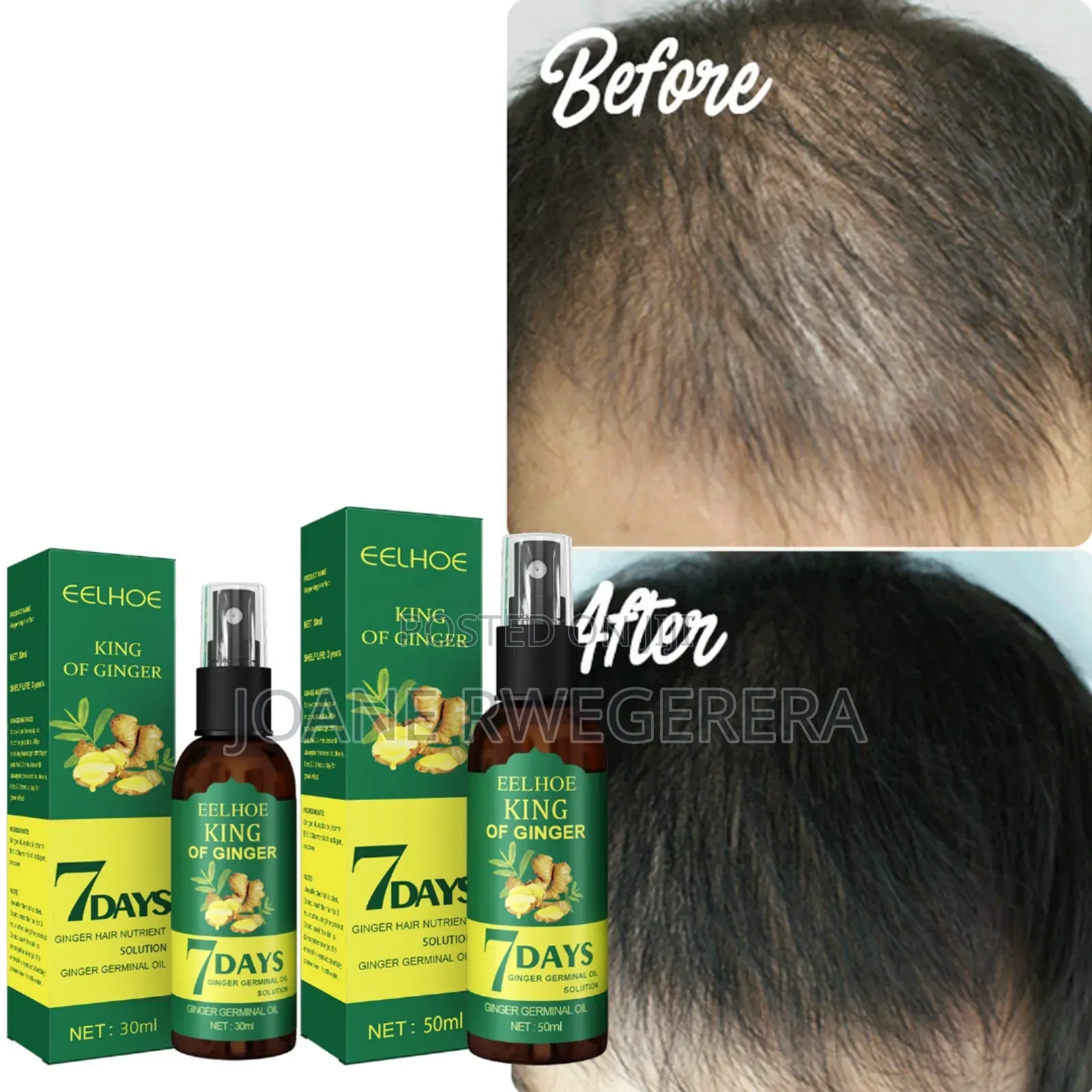 King Ginger 7 Days Hair Serum in Kinondoni - Hair Beauty, Mambo Yote ...